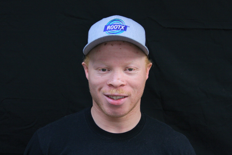 Mitchell Alley - Eastern Regional Sales Manager | RootX